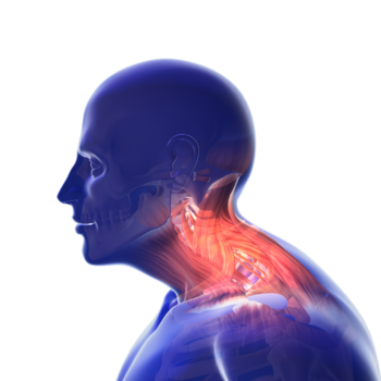 Forward Head Posture